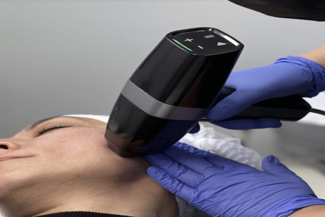 SPA TEAM REVERSO IS A DEEP FRACTIONAL RF DEVICE, OFFERING HIGHLY ...